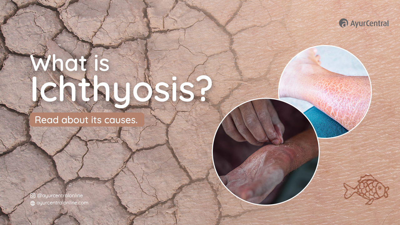 causes the dryness in your skin - AyurCentral Online